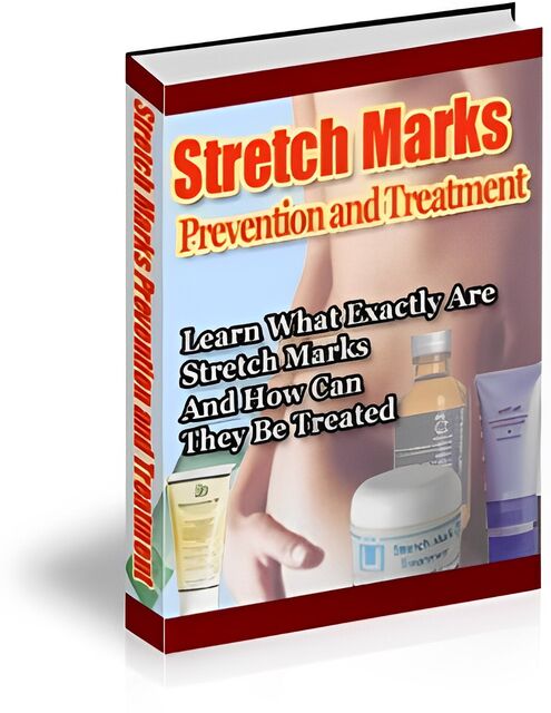 Stretch Marks Prevention and Treatment Guide